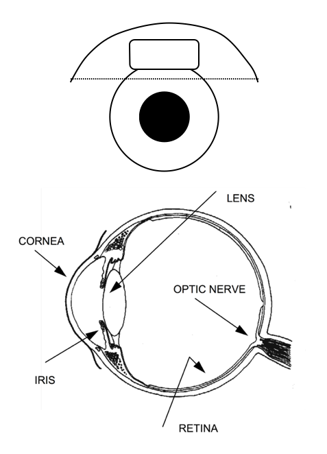Liverpool Eye Clinic - Glaucoma